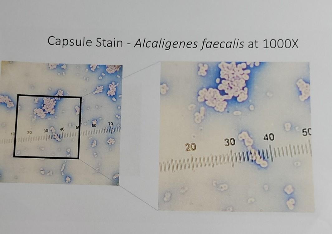 Solved Capsule Stain - Alcaligenes faecalis at 1000X 30 10 | Chegg.com