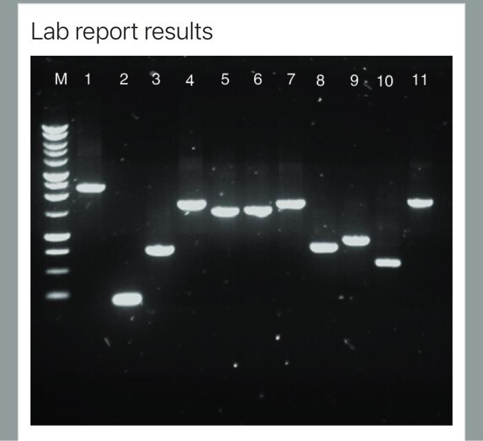 Solved 1. Measure out 1 g of agarose 2. Pour agarose powder | Chegg.com