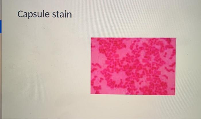 Solved Capsule stain | Chegg.com