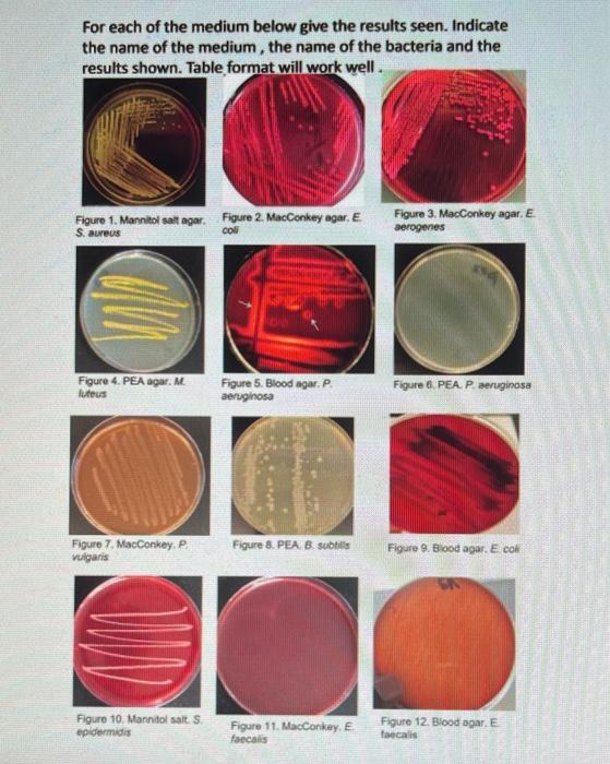 Enterococcus Faecalis Macconkey Agar