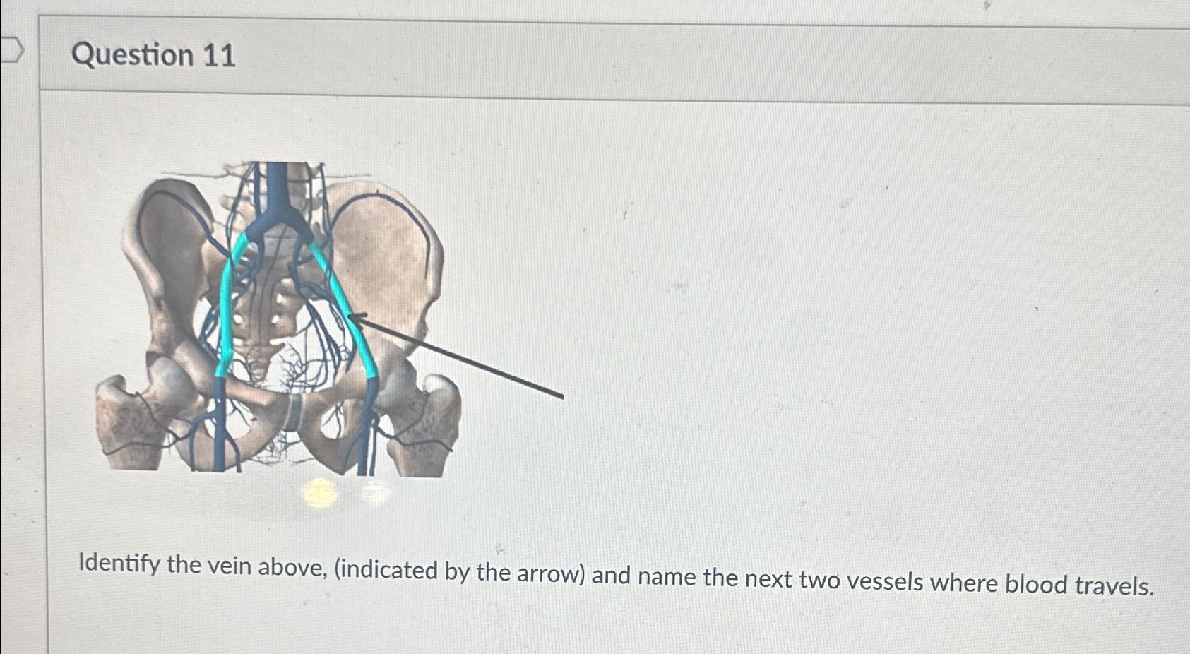 Solved Question 11Identify the vein above, (indicated by the | Chegg.com