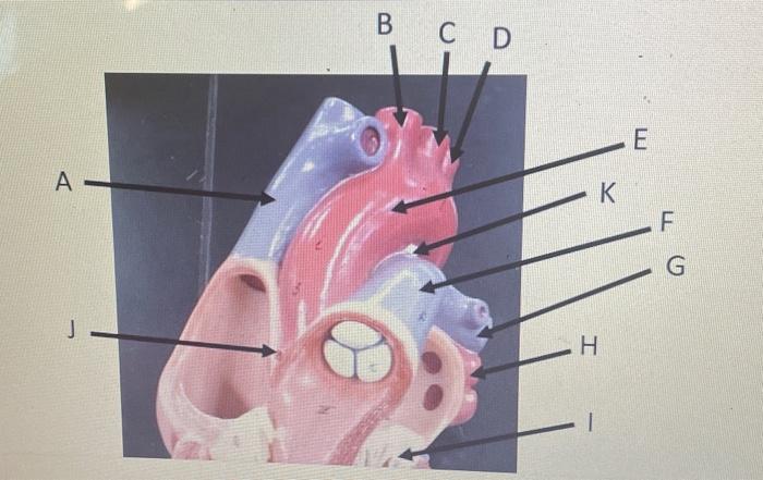 Solved identify the vessels and structures. specify vein or | Chegg.com