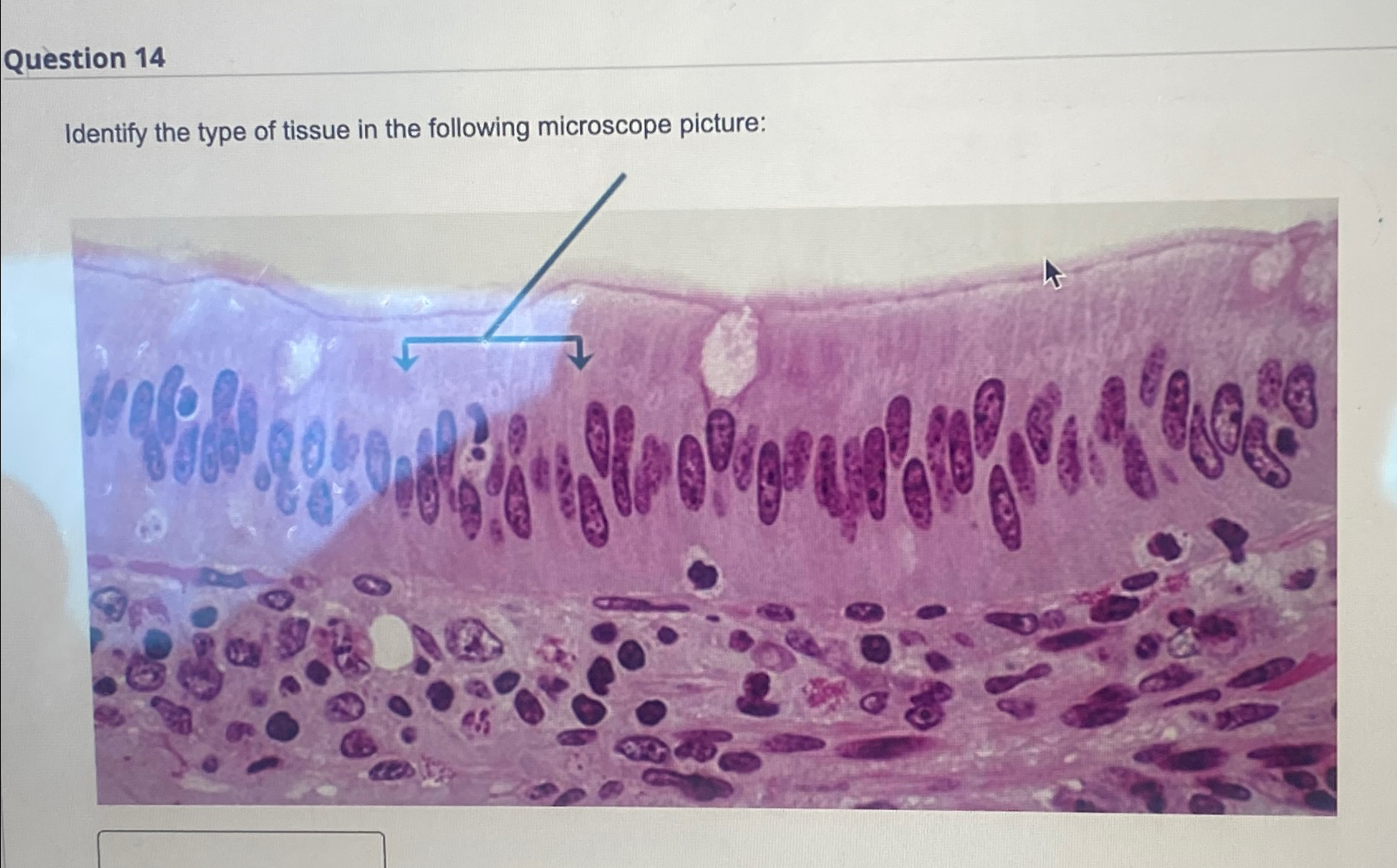 Solved Question 14Identify the type of tissue in the | Chegg.com
