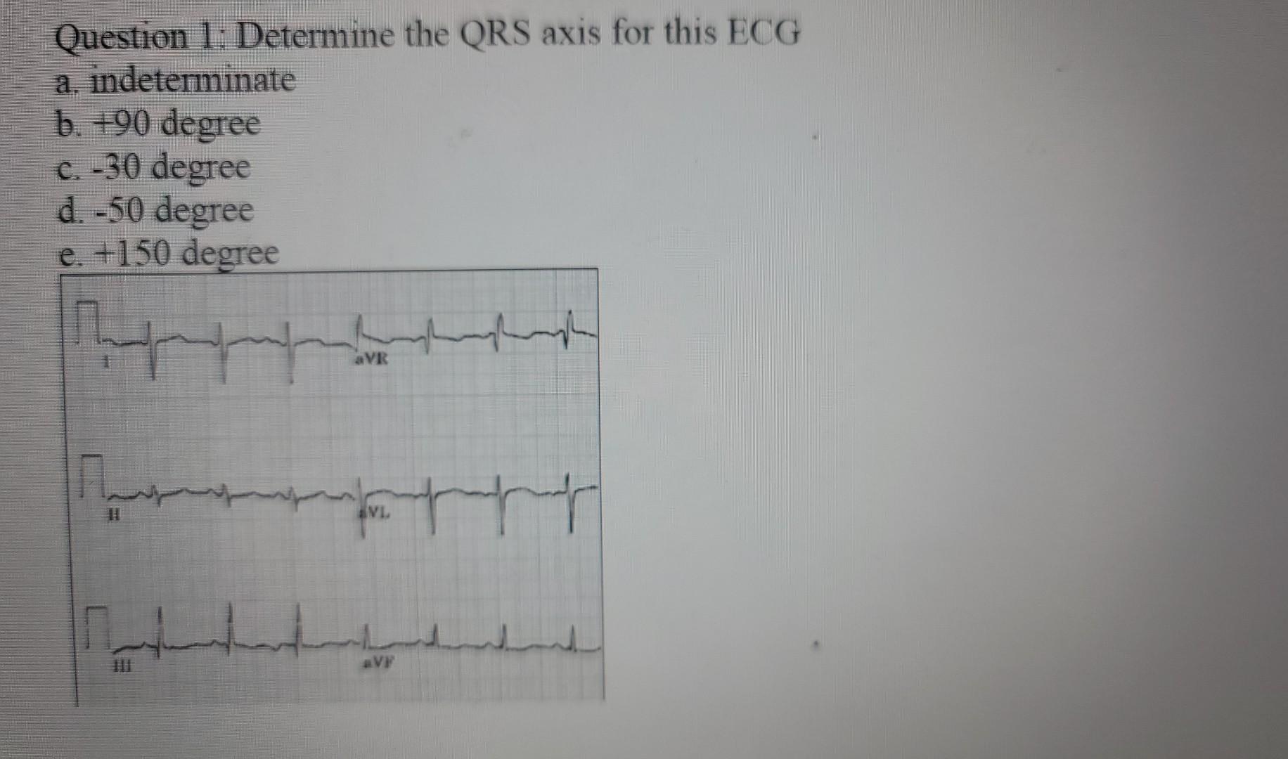 Solved Question 1: Determine the QRS axis for this ECG a. | Chegg.com