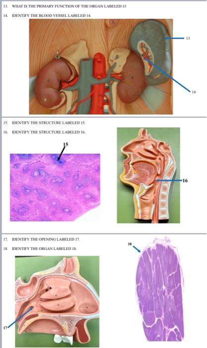 Solved 13. WHAT 1S THIE PRIMARY FUNCTION OF THE OPCAN LABEH | Chegg.com