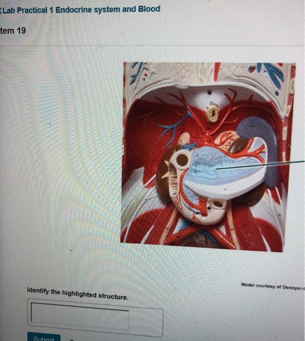 Solved Lab Practical 1 Endocrine system and Blood tem 19 | Chegg.com