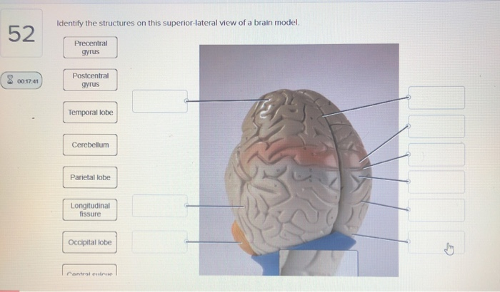 Solved Identify the structures on this superior-lateral view | Chegg.com Solved Identify the structures on this superior-lateral view | Chegg.com