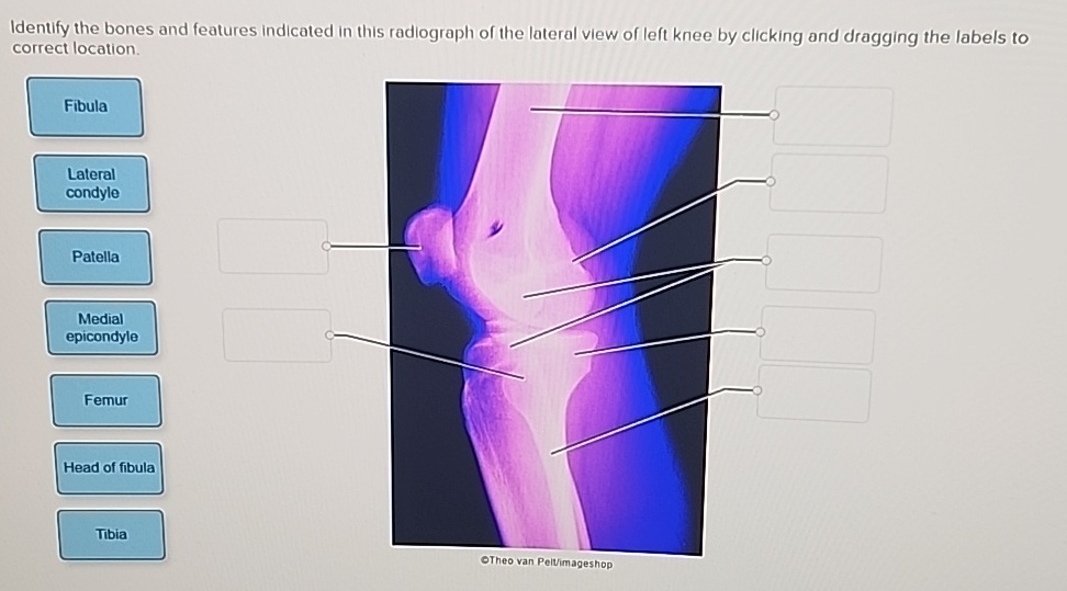 Solved Identify the bones and features indicated in this | Chegg.com