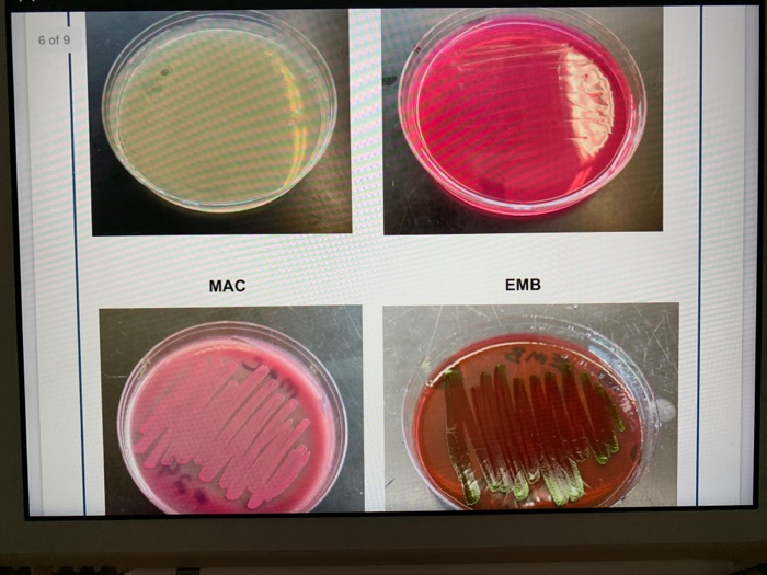 Solved PEA Result Interpretation Presumptive ID E.coli P. | Chegg.com