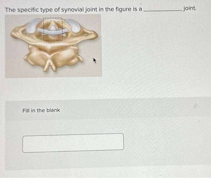 Solved The specific type of synovial joint in the figure is | Chegg.com
