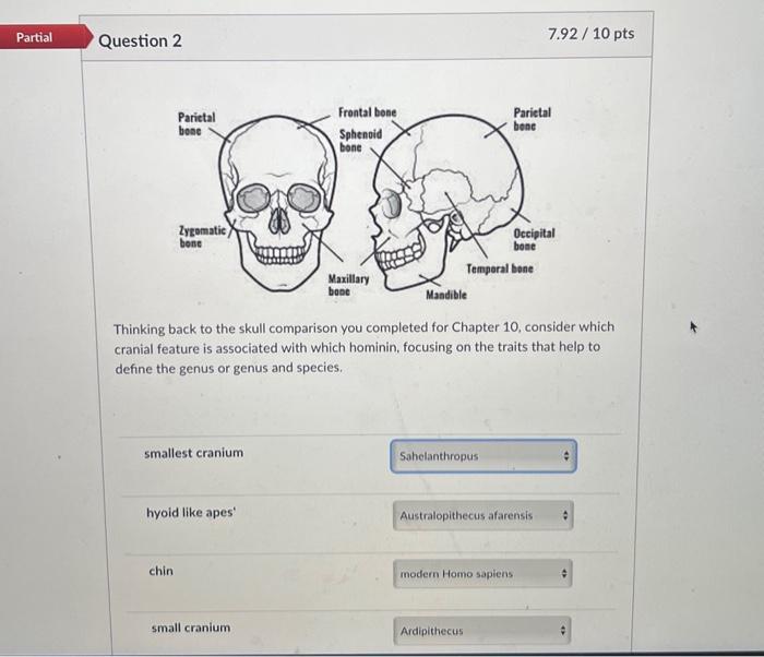 can you check which ones are the incorrect answers | Chegg.com