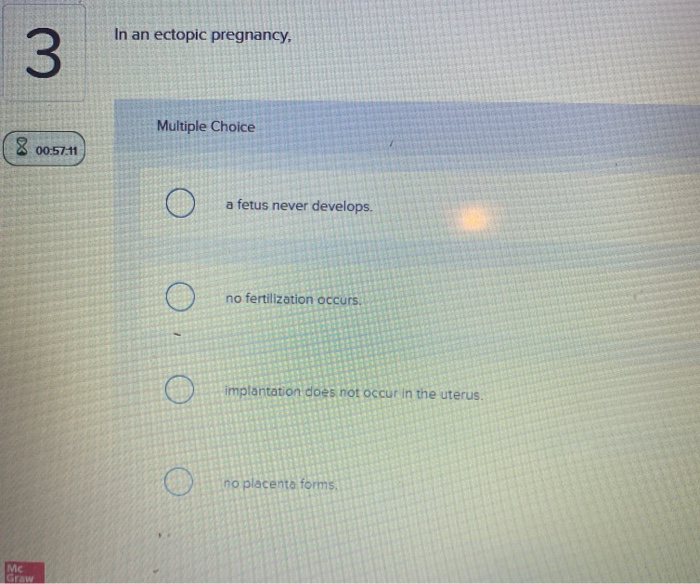 Solved In an ectopic pregnancy, Multiple Choice (3 oosm) 1 o | Chegg.com