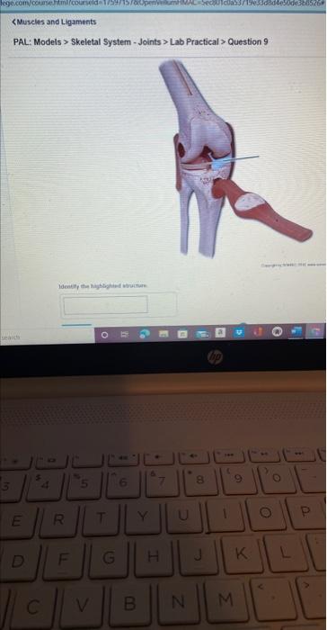 Solved PAL: Models > Skeletal System - Joints > Lab | Chegg.com