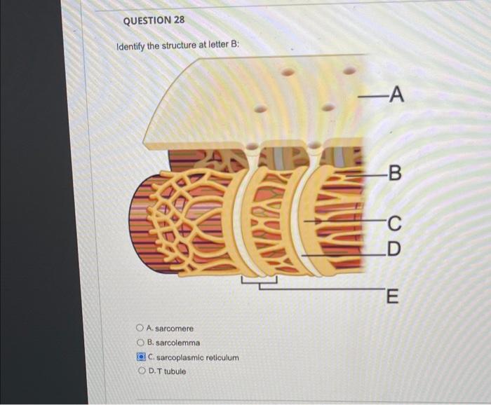 Solved QUESTION 25 After death, muscle fibers run out of ATP | Chegg.com