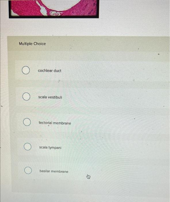 Solved Which structure is highlighted? Multiple Choice О | Chegg.com