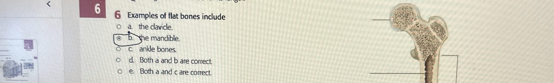 Solved 66 ﻿Examples of flat bones includea. ﻿the | Chegg.com