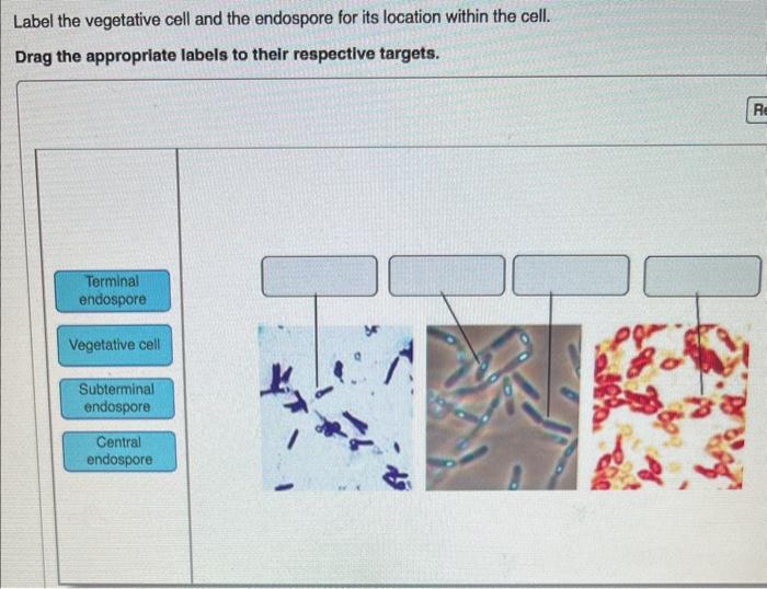 Solved Label the vegetative cell and the endospore for its | Chegg.com
