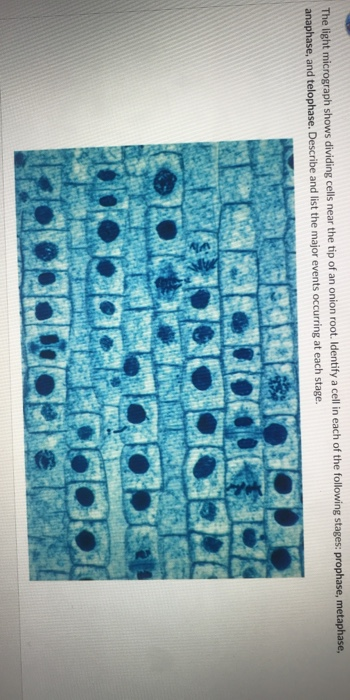 Solved The light micrograph shows dividing cells near the | Chegg.com