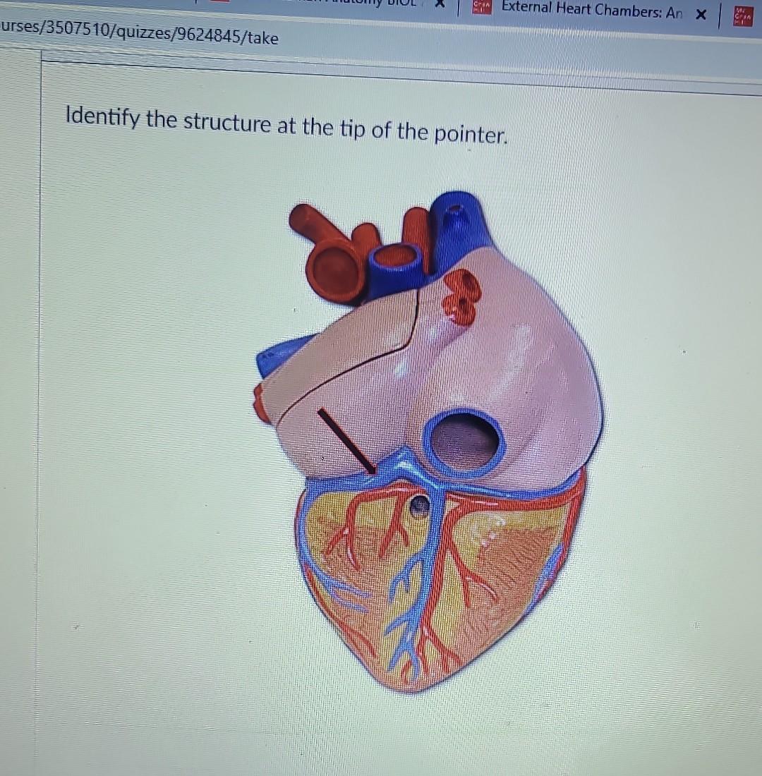 Solved Identify the part of the conducting system at the tip | Chegg.com