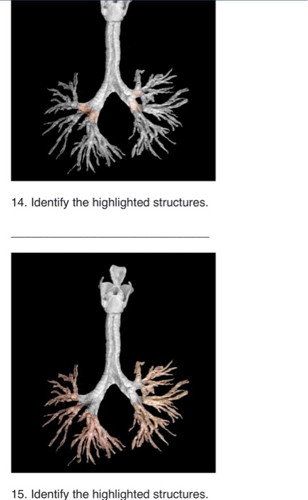Solved 14. Identify the highlighted structures. 15. Identify | Chegg.com Solved 14. Identify the highlighted structures. 15. Identify | Chegg.com