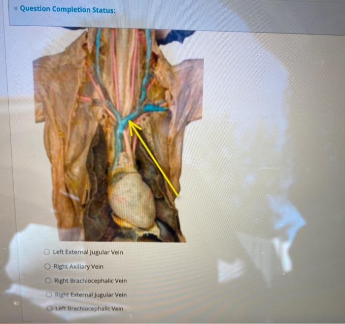 Solved Question Completion Status: Left External jugular | Chegg.com