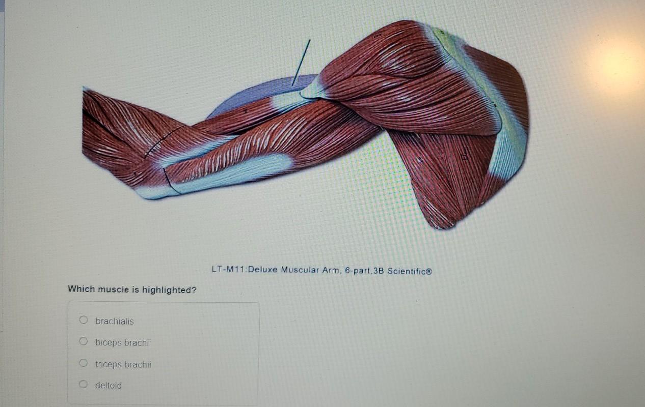 Solved Hello. Can you please identify the muscle name of the | Chegg.com
