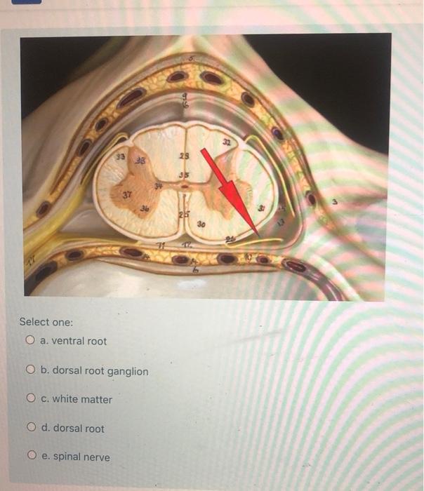 Solved Select one: a. axon O b. neurolemma O c. myelin | Chegg.com