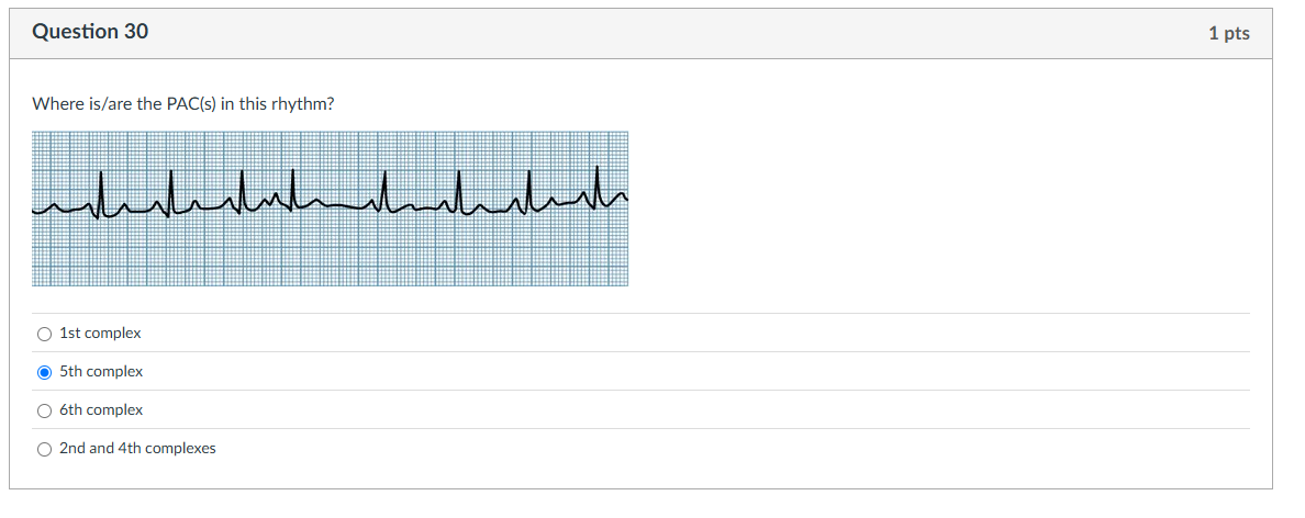 Solved Question 30Where is/are the PAC(s) ﻿in this | Chegg.com