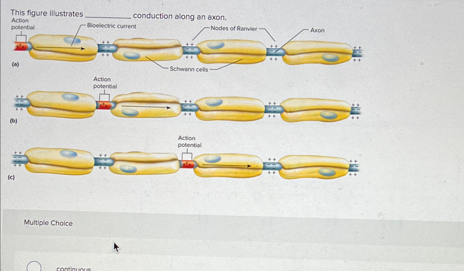 Solved This figure illustrates q, ﻿conduction along an axon. | Chegg.com