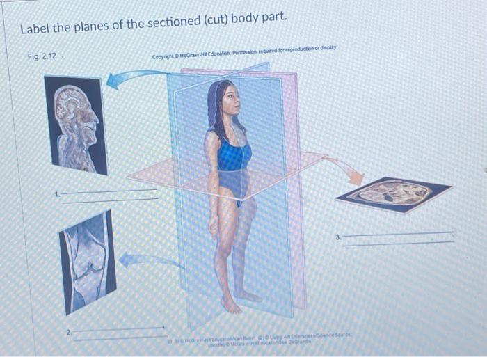 Solved Label the planes of the sectioned (cut) body part. | Chegg.com