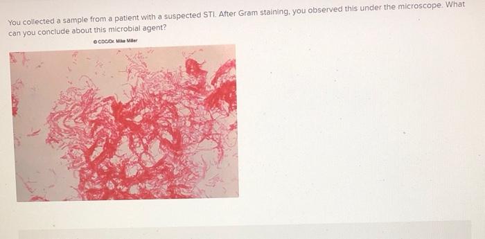 Solved You collected a sample from a patient with a | Chegg.com