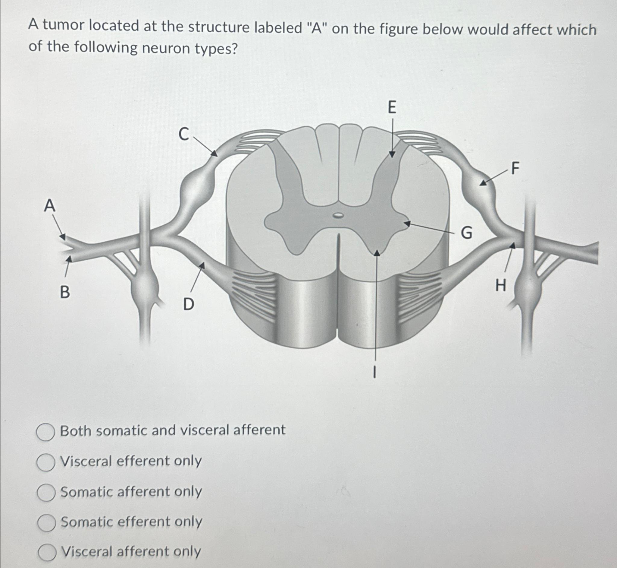 Solved A tumor located at the structure labeled " A " ﻿on | Chegg.com