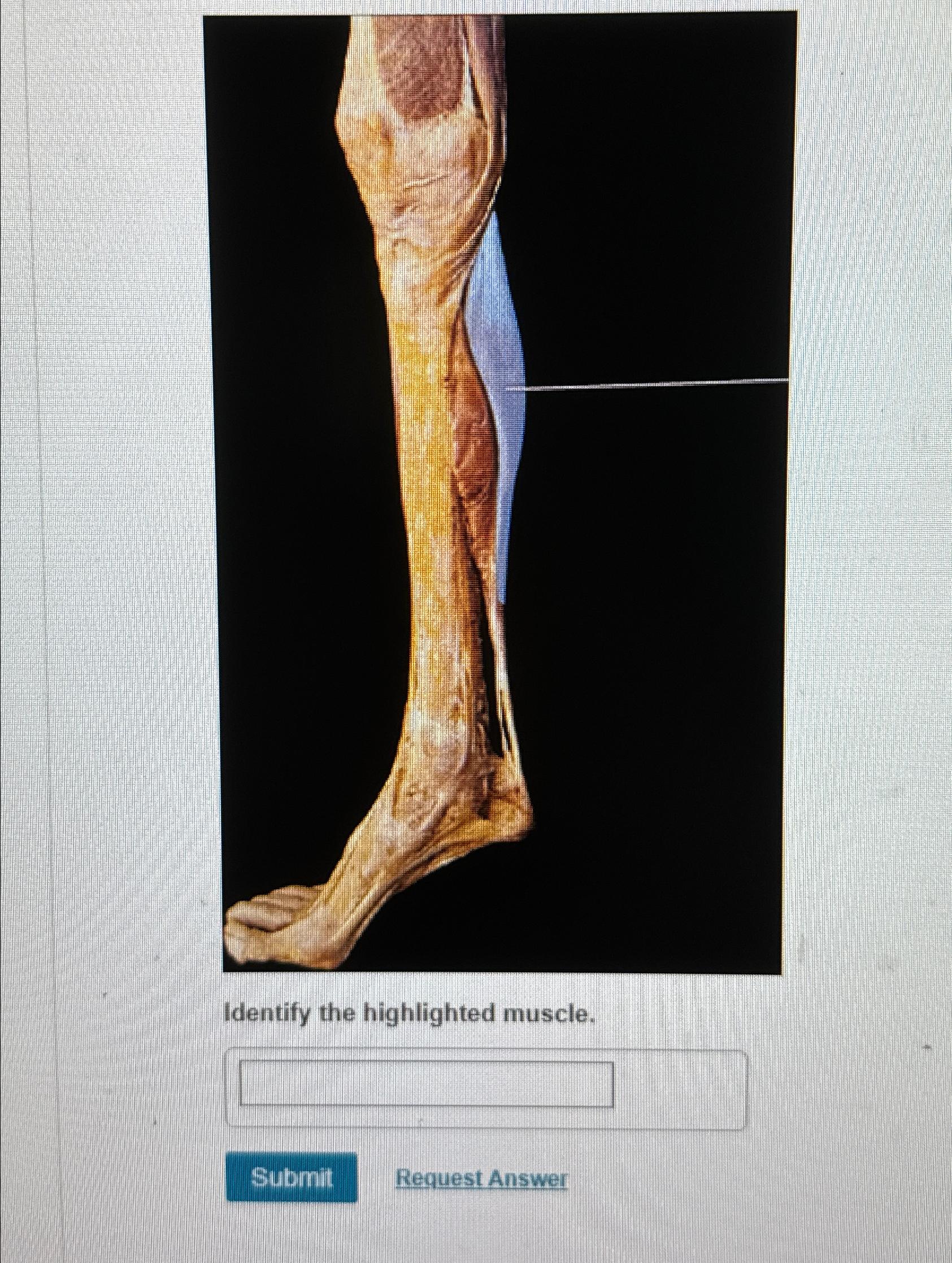Solved Identify the highlighted muscle. | Chegg.com