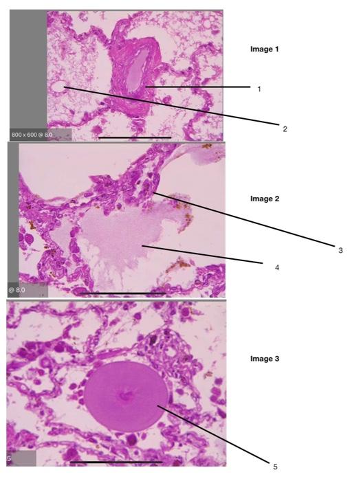 Solved Below is some histology slides of a normal lung. I | Chegg.com