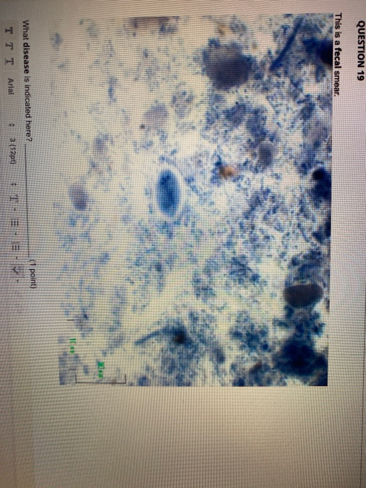 Solved QUESTION 19 This is a fecal smear. (1 point) What | Chegg.com