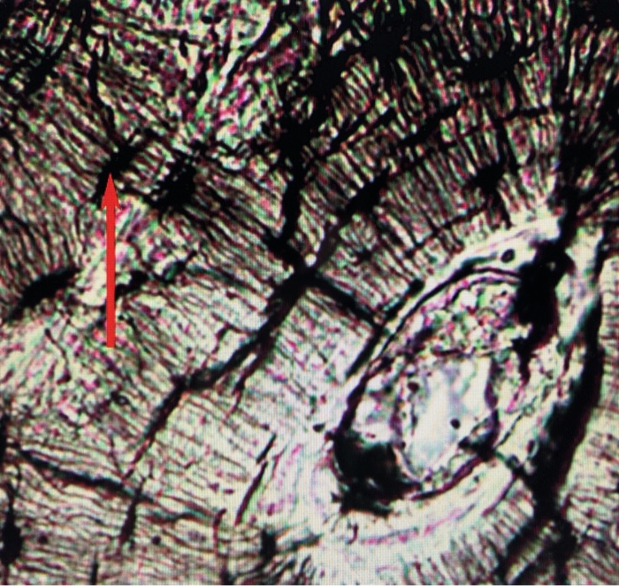 Solved which cell is located in the structure at the end of | Chegg.com