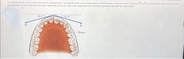 Solved The drawing shows we tooth trace uted by | Chegg.com