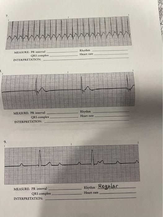 Solved MEASURE PR interval Rhythm QRS complex Heart rate | Chegg.com