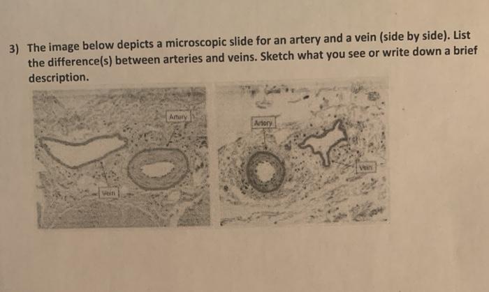 Solved 3) The image below depicts a microscopic slide for an | Chegg.com