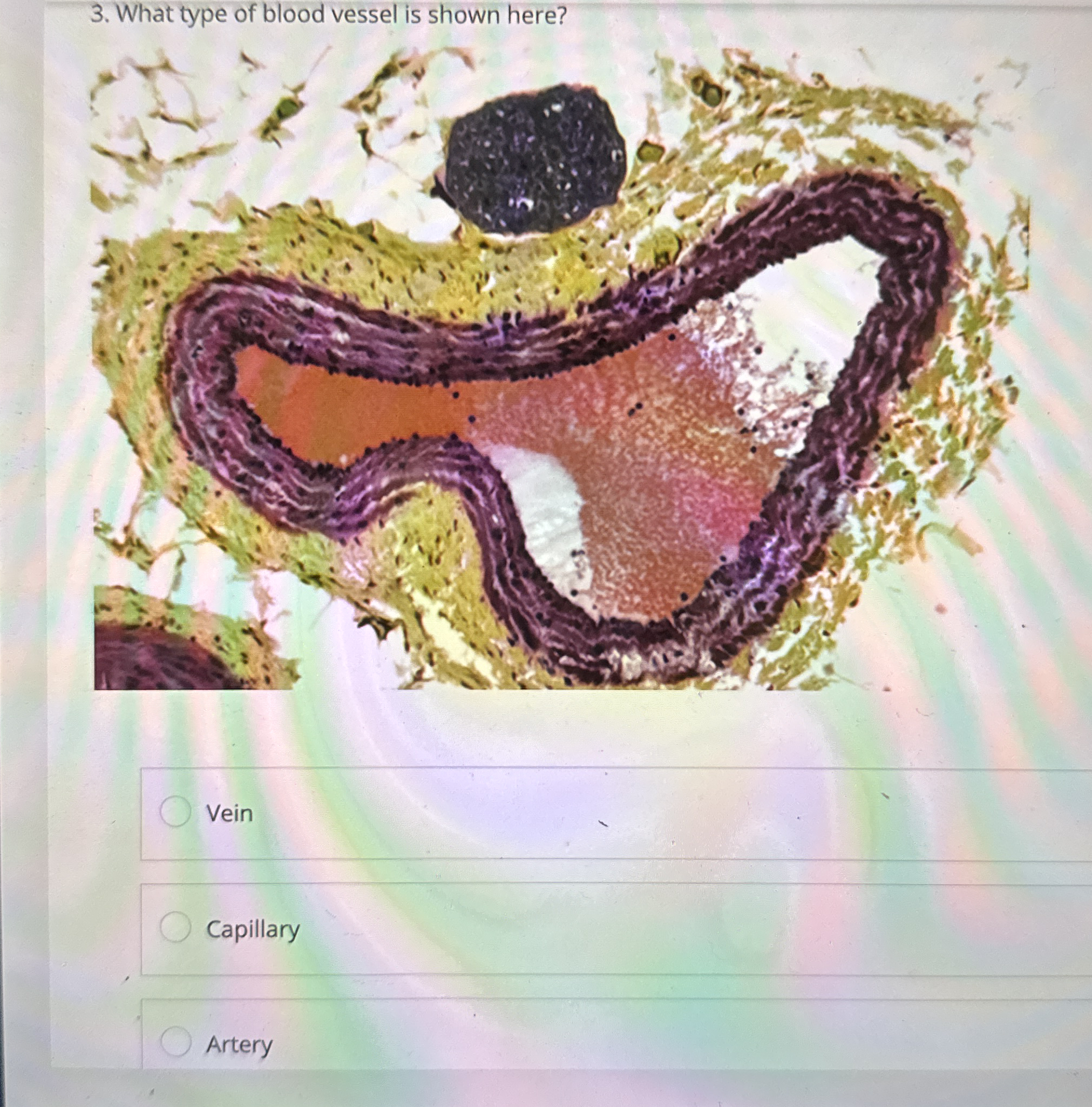 Solved What type of blood vessel is shown | Chegg.com