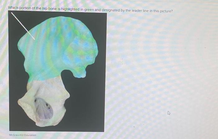 Which portion of the hip bone is highlighted in green | Chegg.com