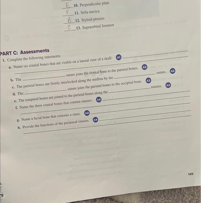 PART B: Assessments Match the bones in coluens A with | Chegg.com