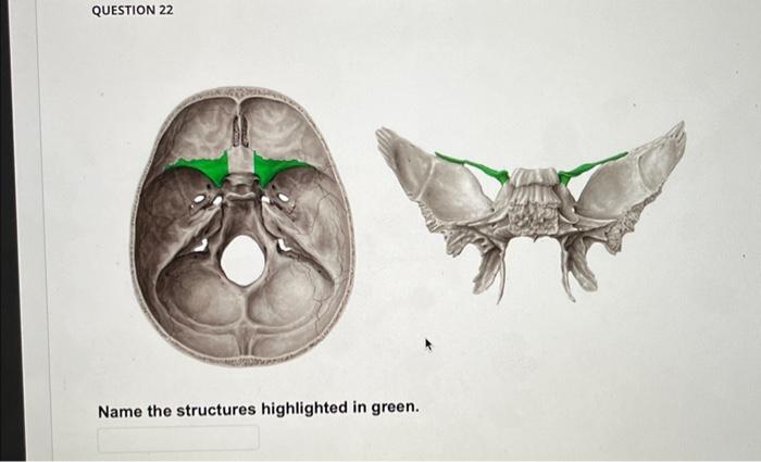 QUESTION 18 Identify the structure highlighted in | Chegg.com