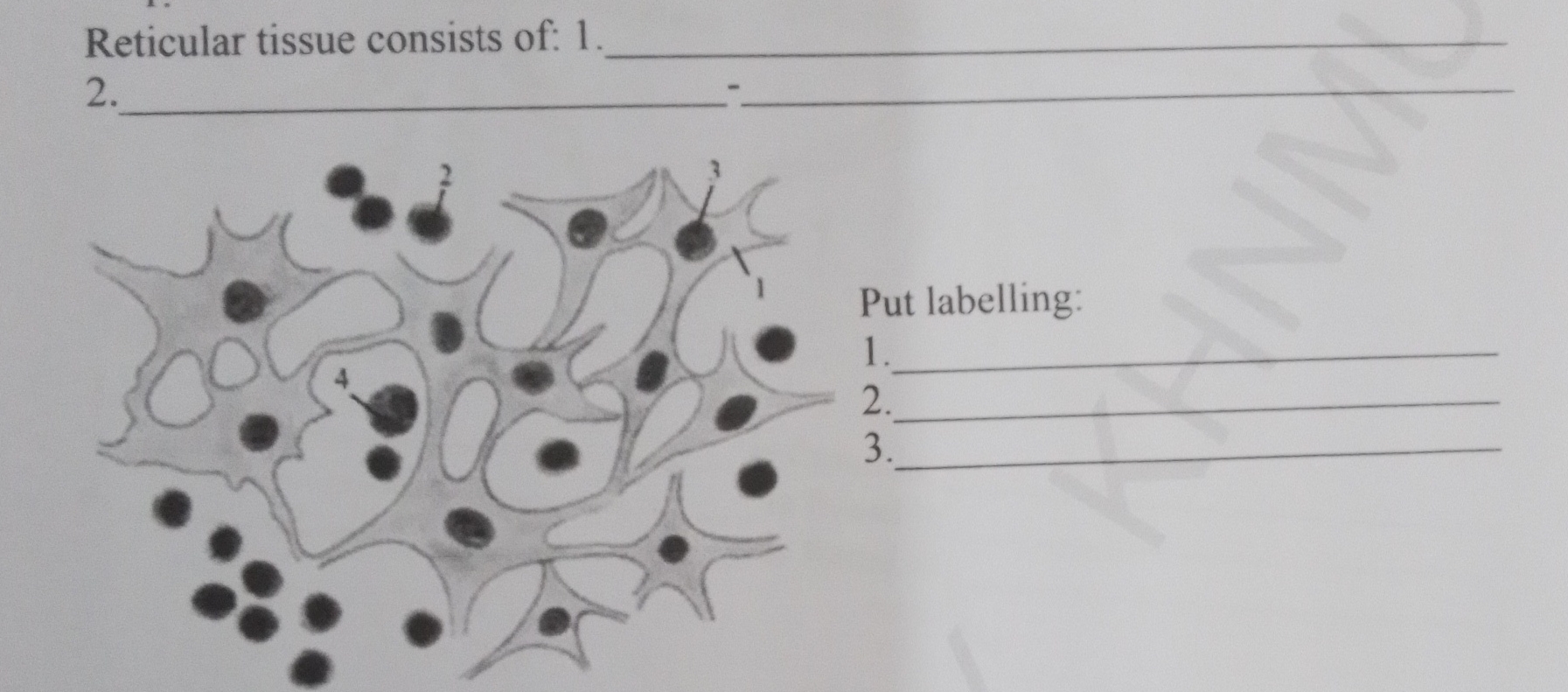 Solved Reticular tissue consists of: 1. q,2. q,q,Put | Chegg.com