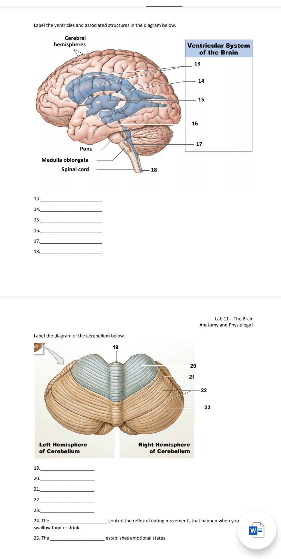 Solved Label the ventricles and associated structures in the | Chegg.com