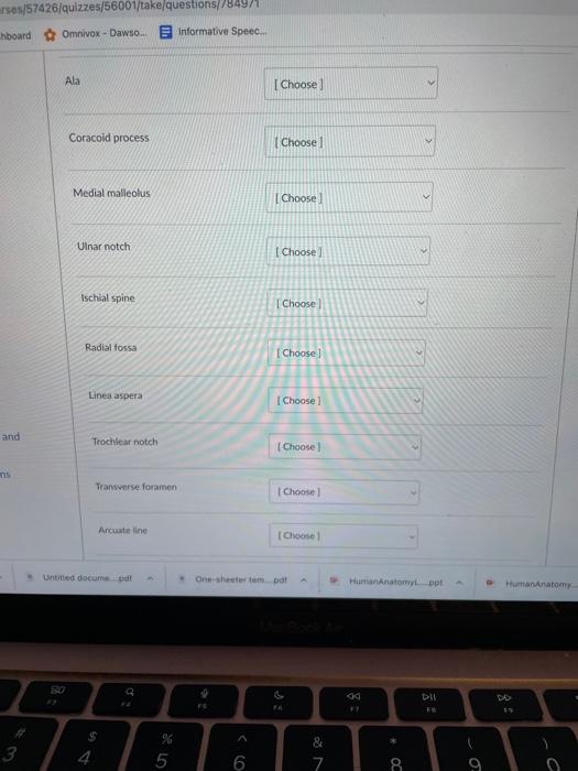 Solved Match the bony landmark to the appropriate skeletal | Chegg.com