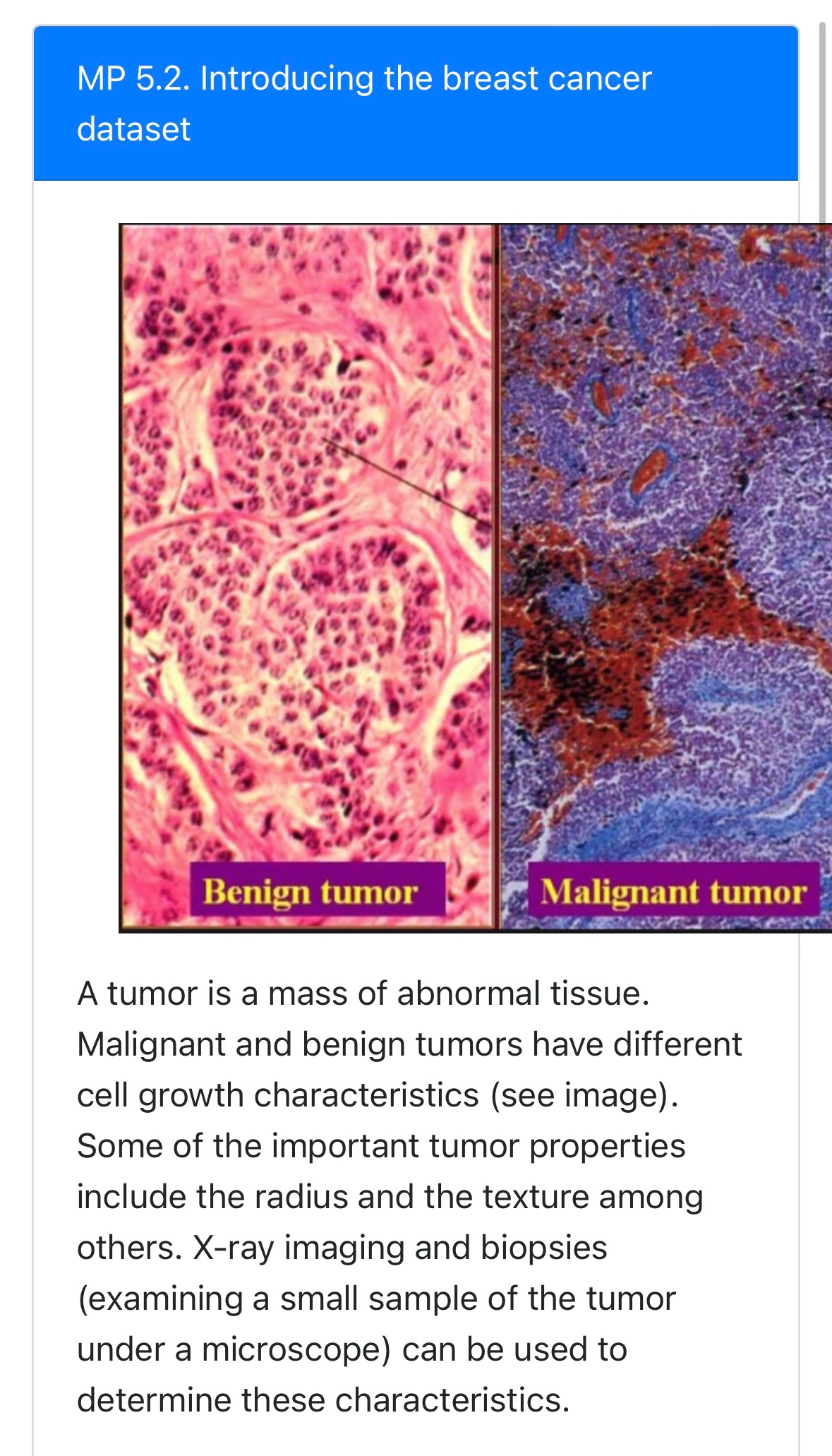 Solved A tumor is a mass of abnormal tissue.Malignant and | Chegg.com