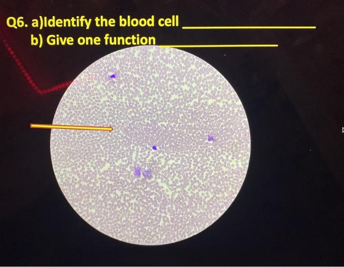 Solved Q3. Identify the blood cell at the tip of the pointer | Chegg.com