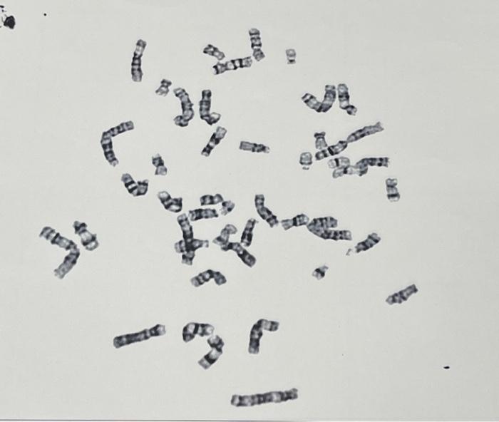Solved need help karyotyping putting it in order | Chegg.com Solved need help karyotyping putting it in order | Chegg.com