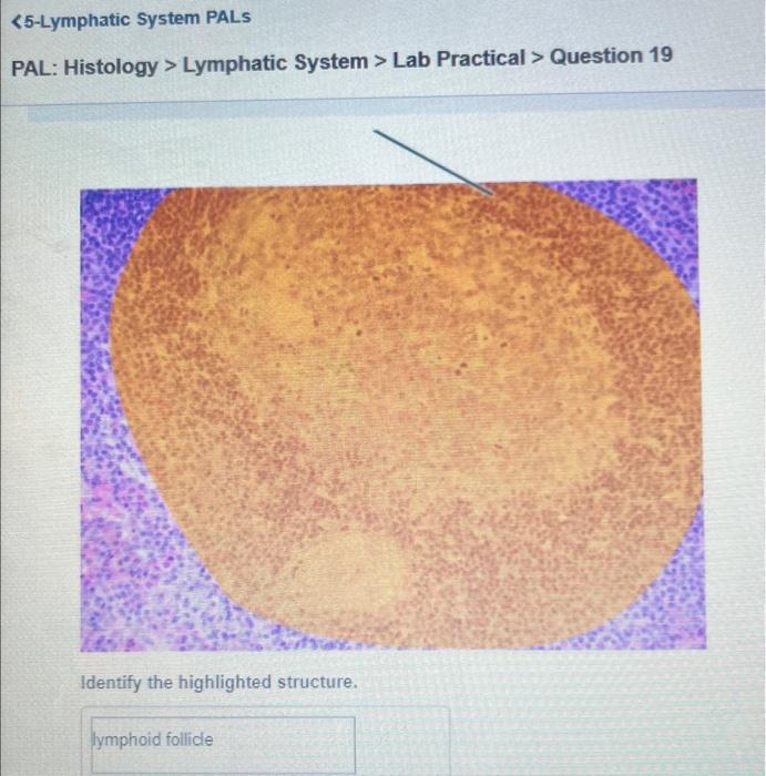 Solved C5-Lymphatic System PALs PAL: Histology > Lymphatic | Chegg.com Solved C5-Lymphatic System PALs PAL: Histology > Lymphatic | Chegg.com